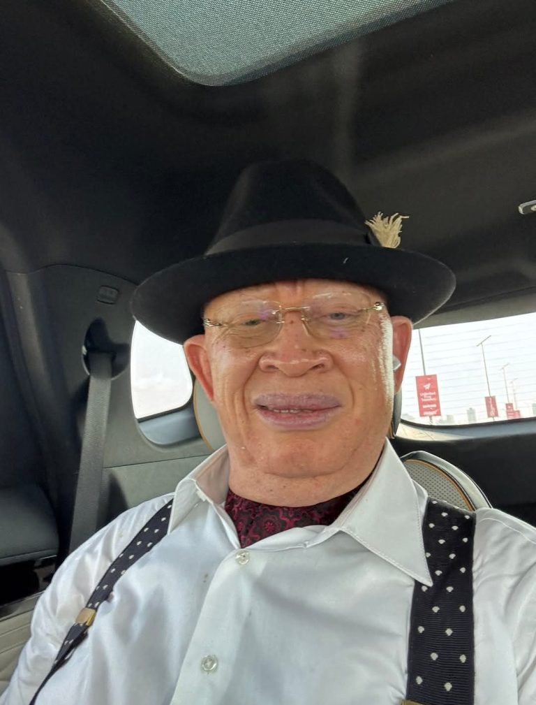 Int'l Albinism Awareness Day 2026: Jake Epelle Calls for Action Beyond ...
